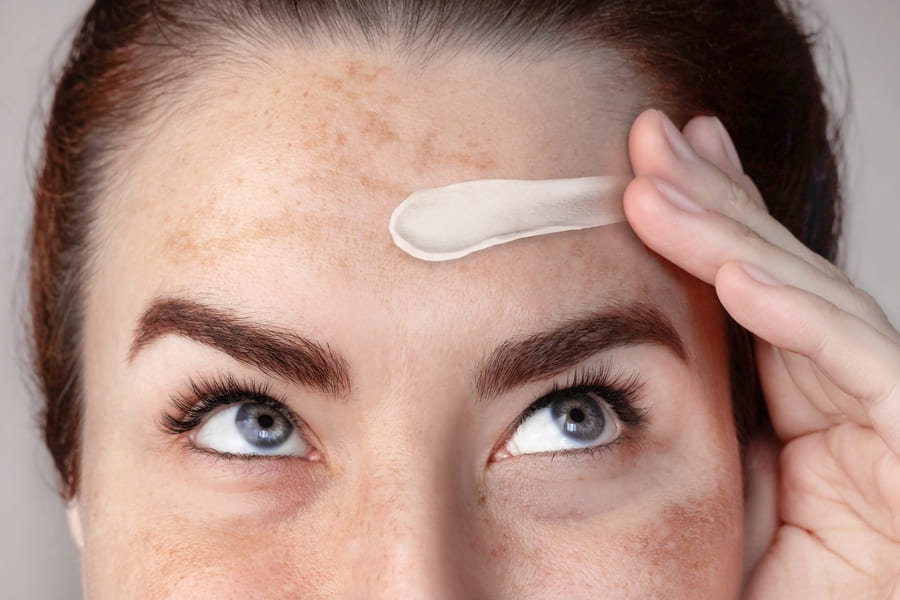 Manchas na pele: ativos aliados para uma pele uniforme • Beleza com ...